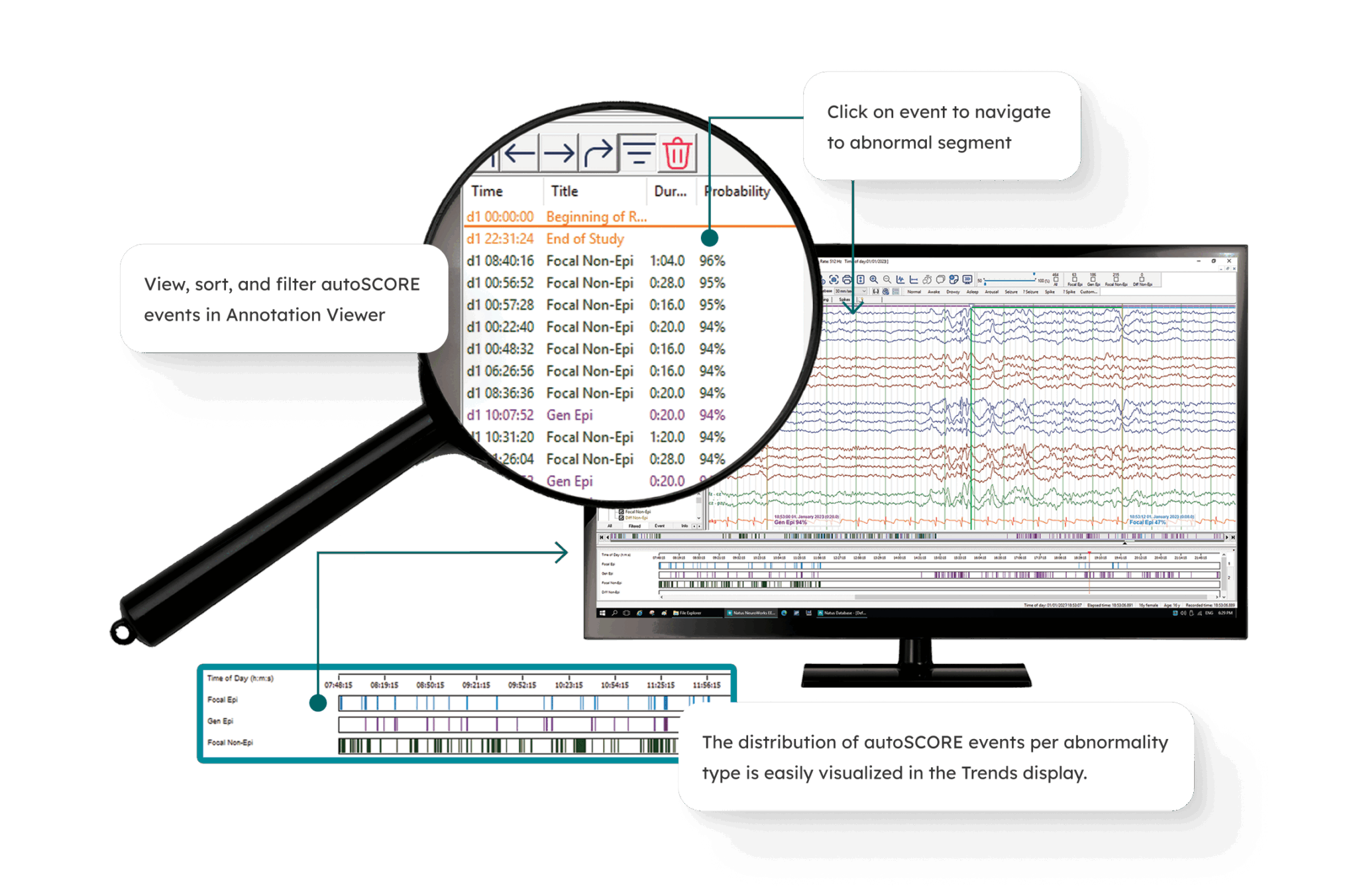 autoSCORE AI EEG Analysis - Natus