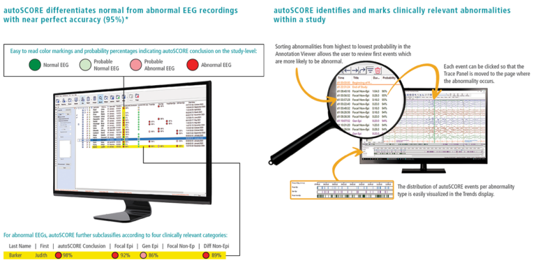 autoSCORE AI EEG Analysis - Natus